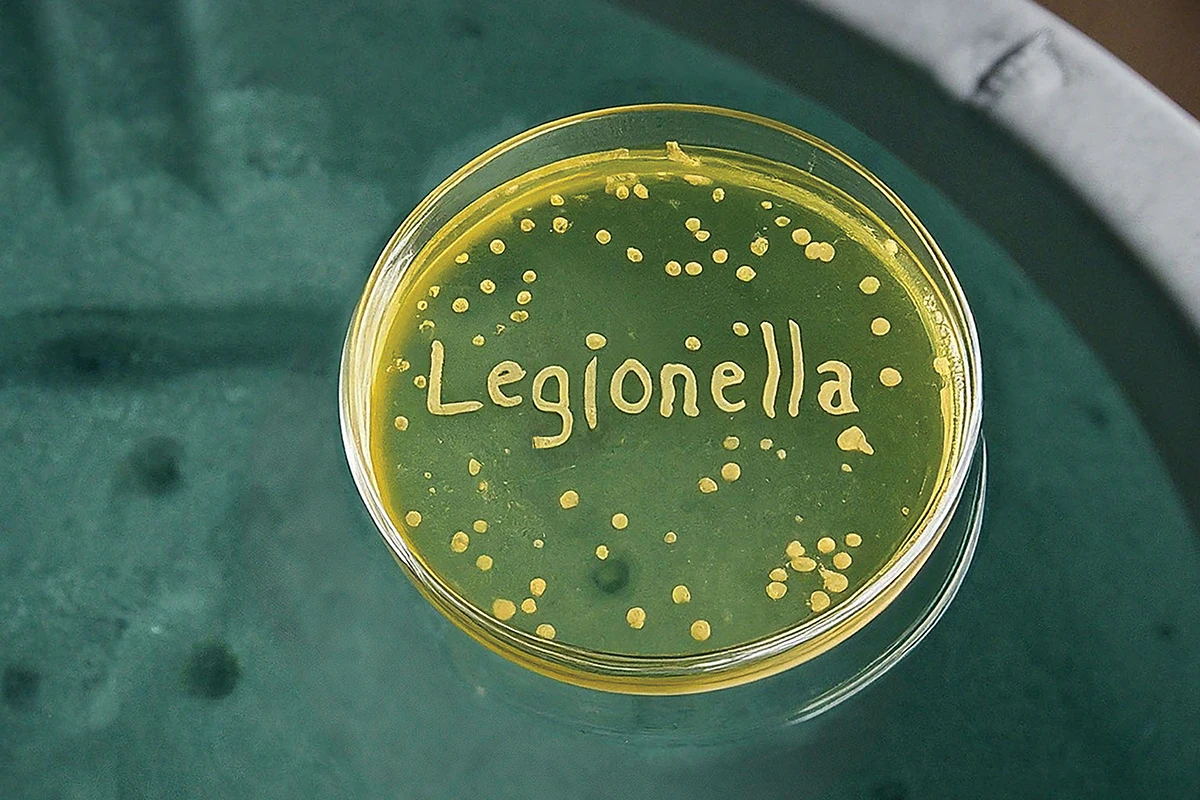 Just the Facts: Legionellosis, Legionnaires' Disease and Pontiac Fever ...